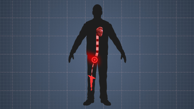 First Aid - Bleeding Emergencies Video - Convergence Training