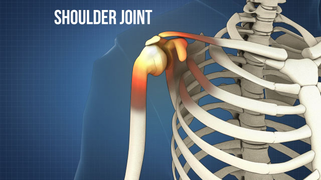 Shoulder Injury Prevention Video - Convergence Training